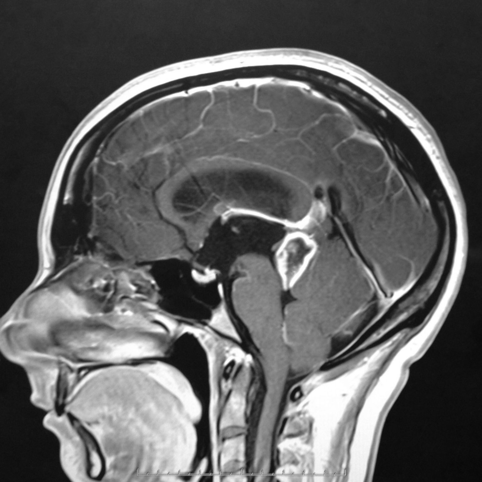 The Impossibilities of Life in the Mind of Someone Healthy - Elephants ...